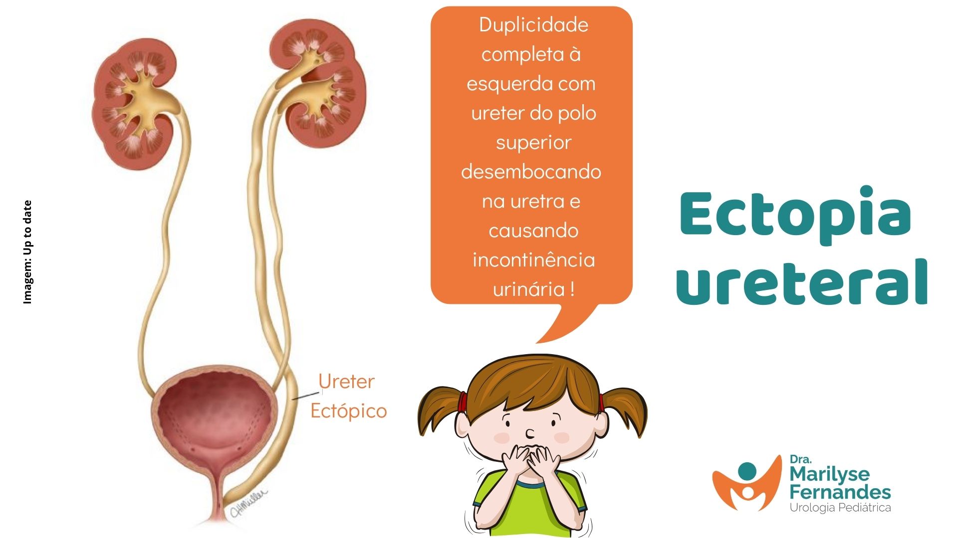 Conheça a duplicidade ureteral: fatores, riscos e cuidados